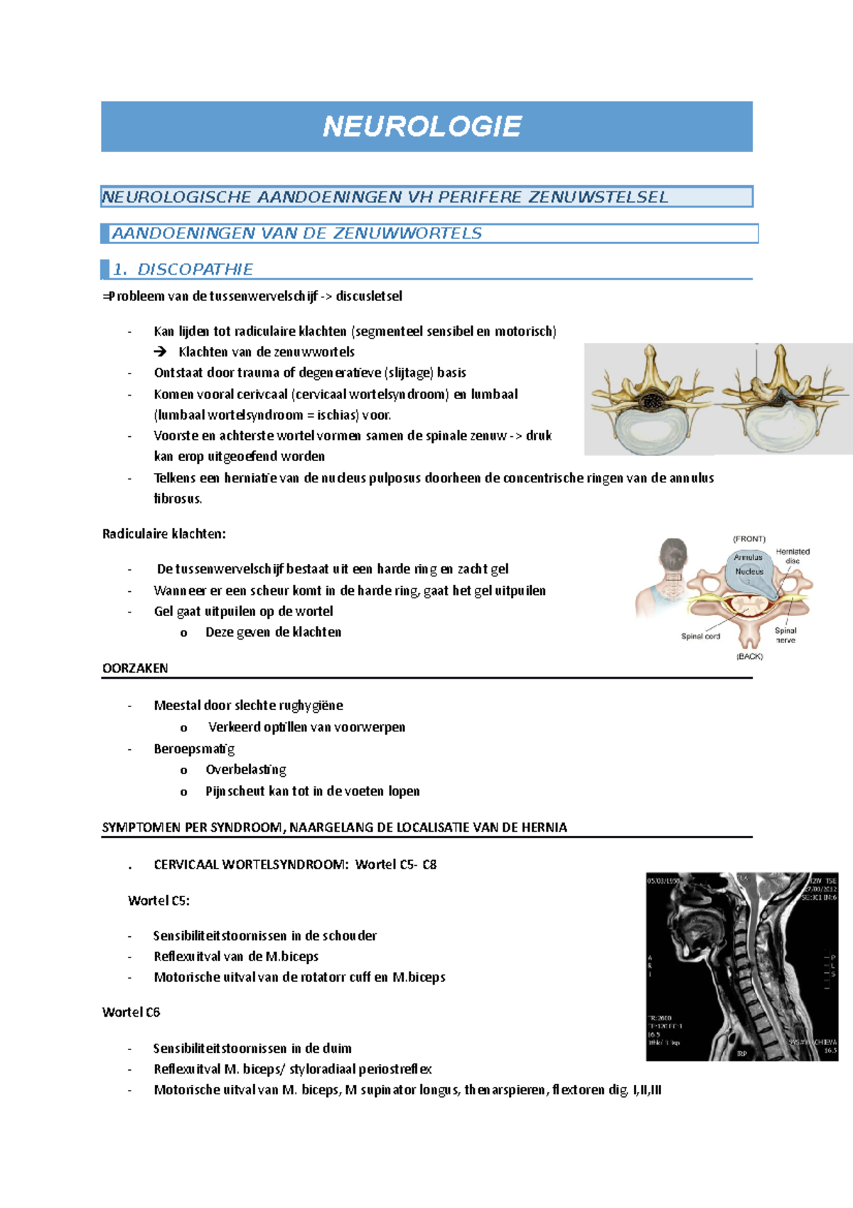Aandoeningen v.h. perifere zenuwstelsel - NEUROLOGIE NEUROLOGISCHE ...