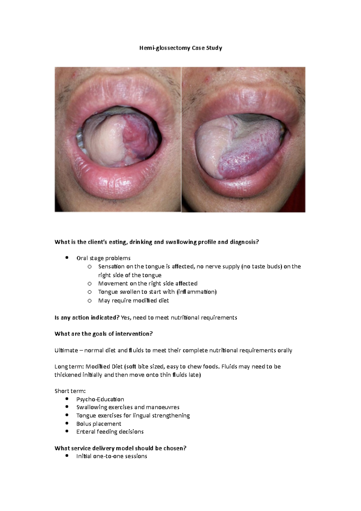 Hemi-glossectomy case study - Hemi-glossectomy Case Study What is the ...