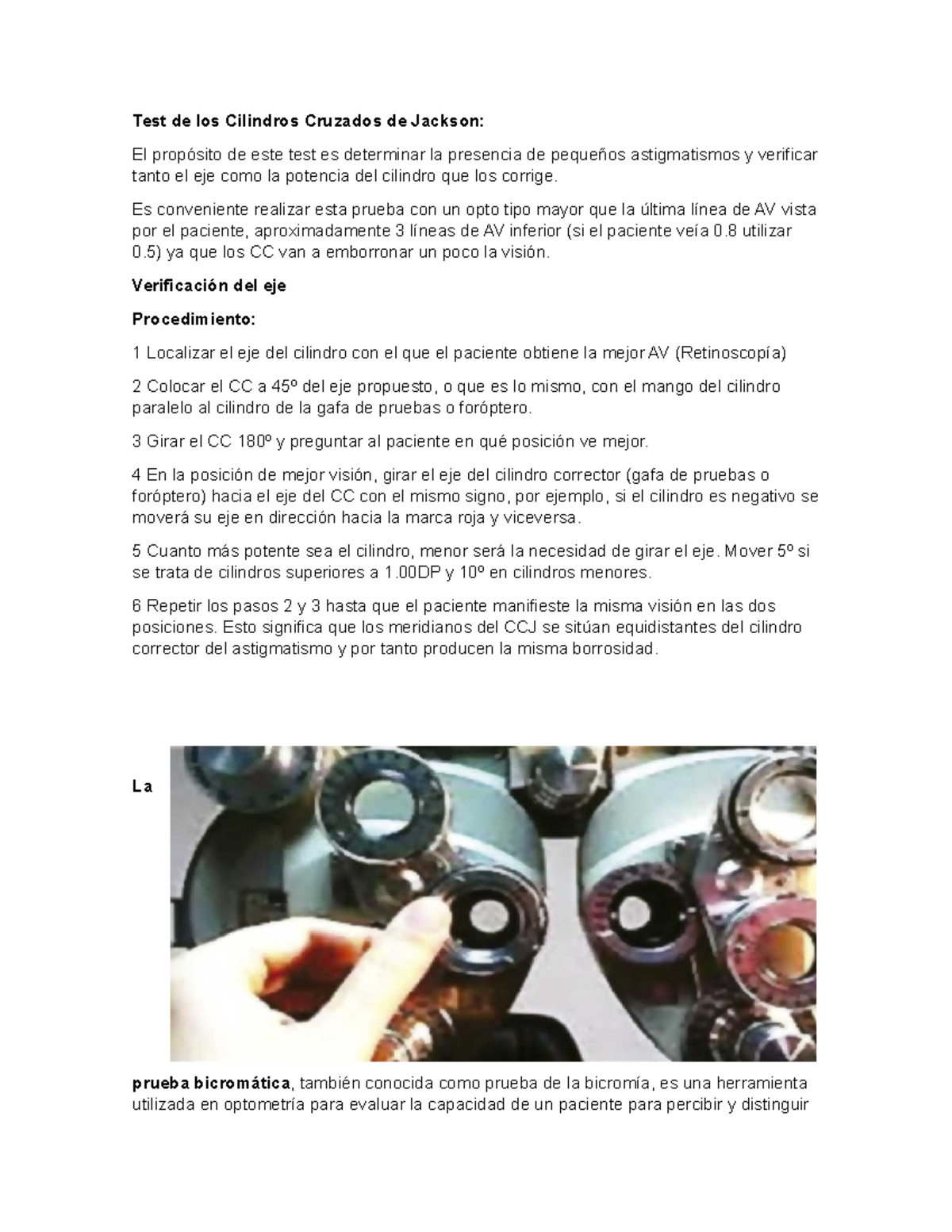 Test de los Cilindros Cruzados de Jackson - Es conveniente realizar ...