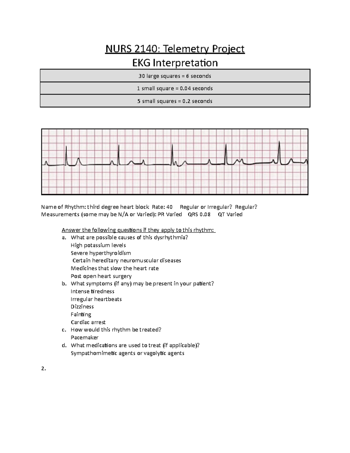 2140 Telemetry Project ( - NURS 2140: Telemetry Project EKG ...