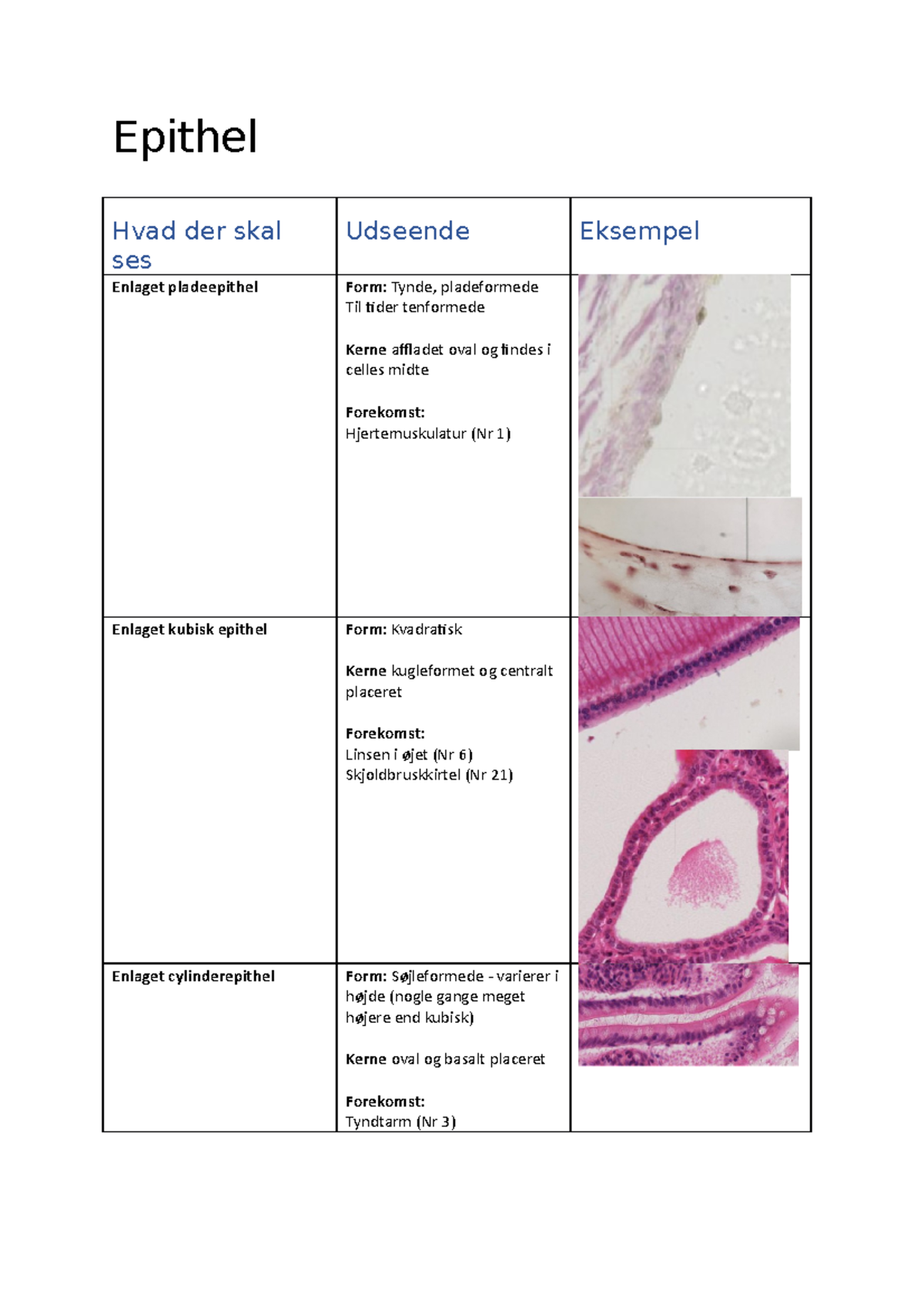 Histologi kompendium - Epithel Hvad der skal ses Udseende Eksempel ...