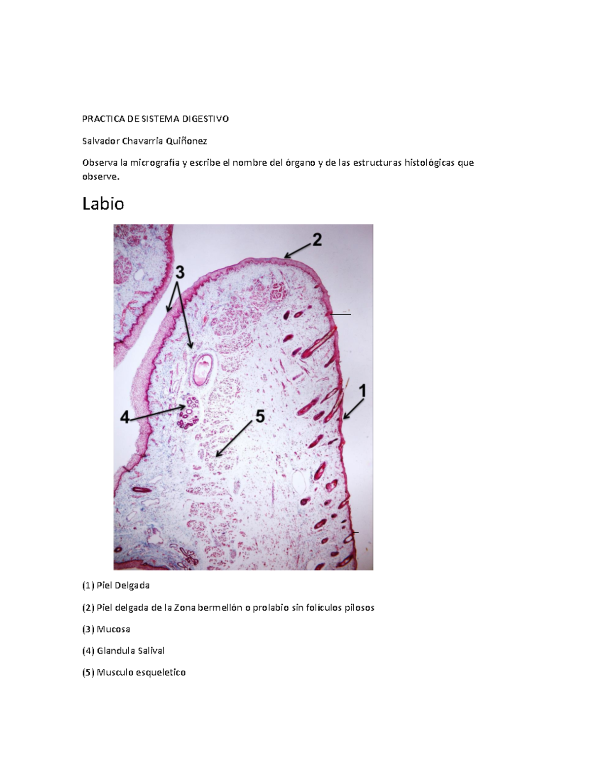Practica DE Lengua, Labio Y Diente - PRACTICA DE SISTEMA DIGESTIVO ...