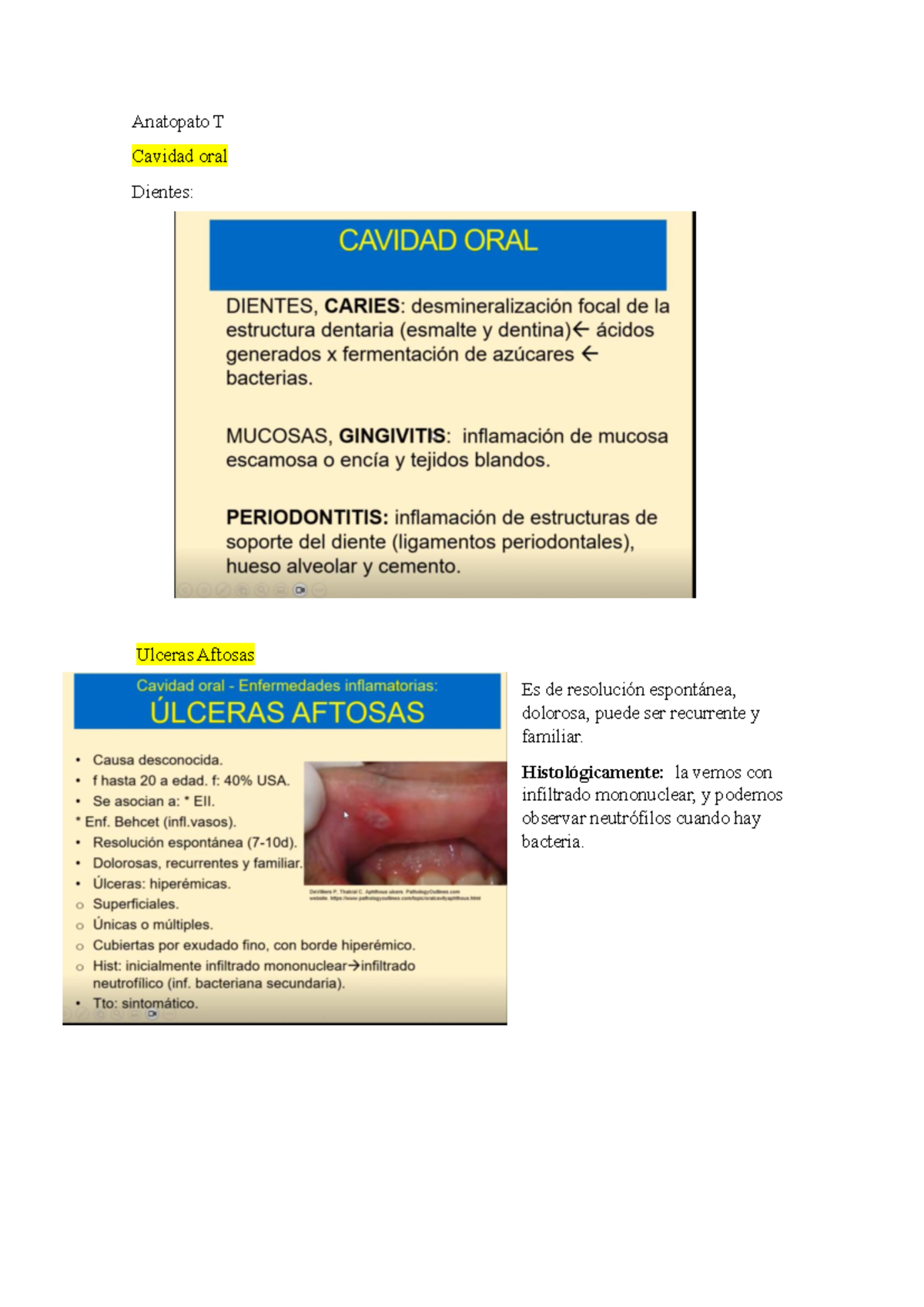 Pato t - Son apuntes - Anatopato T Cavidad oral Dientes: Ulceras ...