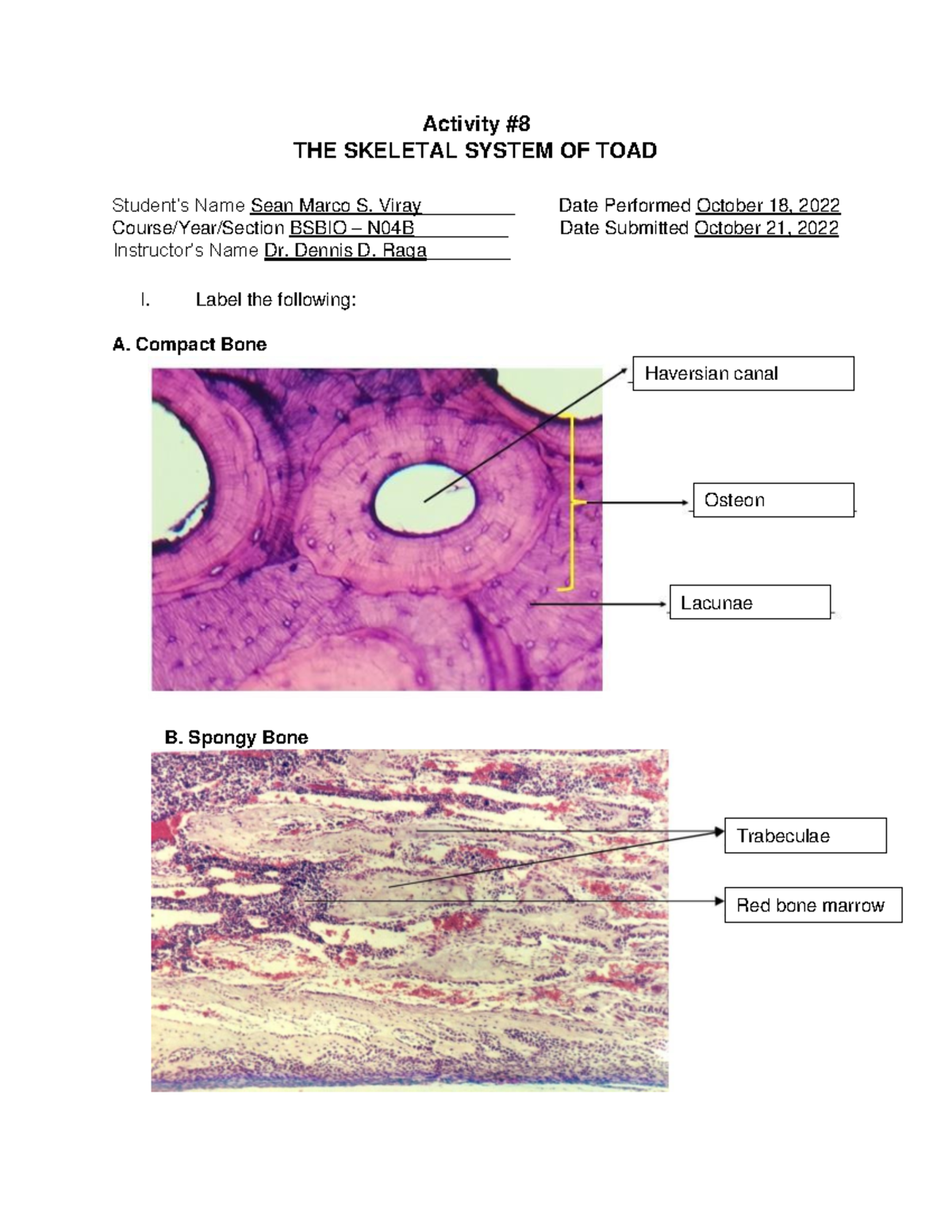 Act08 The Skeletal System Exercise (Viray, Sean Marco S. - Bsbio N04B ...