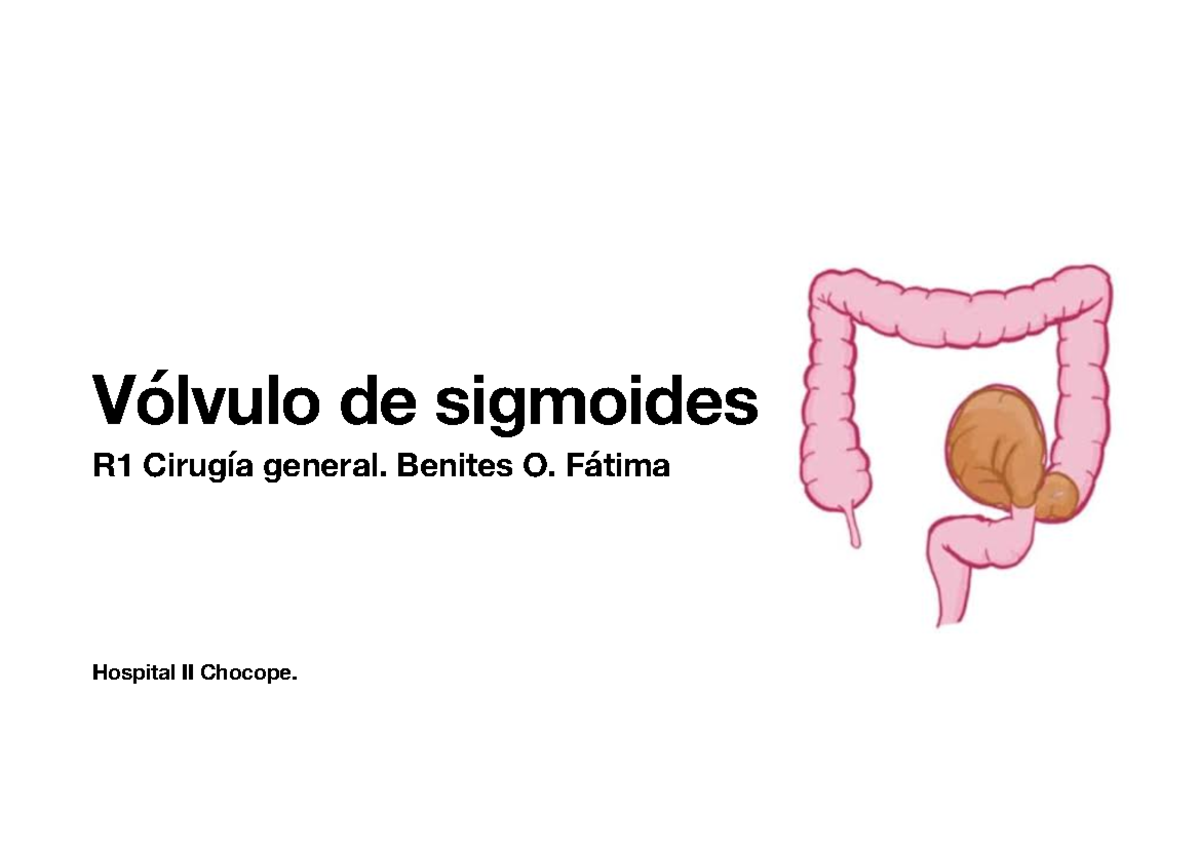 VÓ Lvulo Sigmoides - MEDICINA GENERAL - Documentación en salud ...