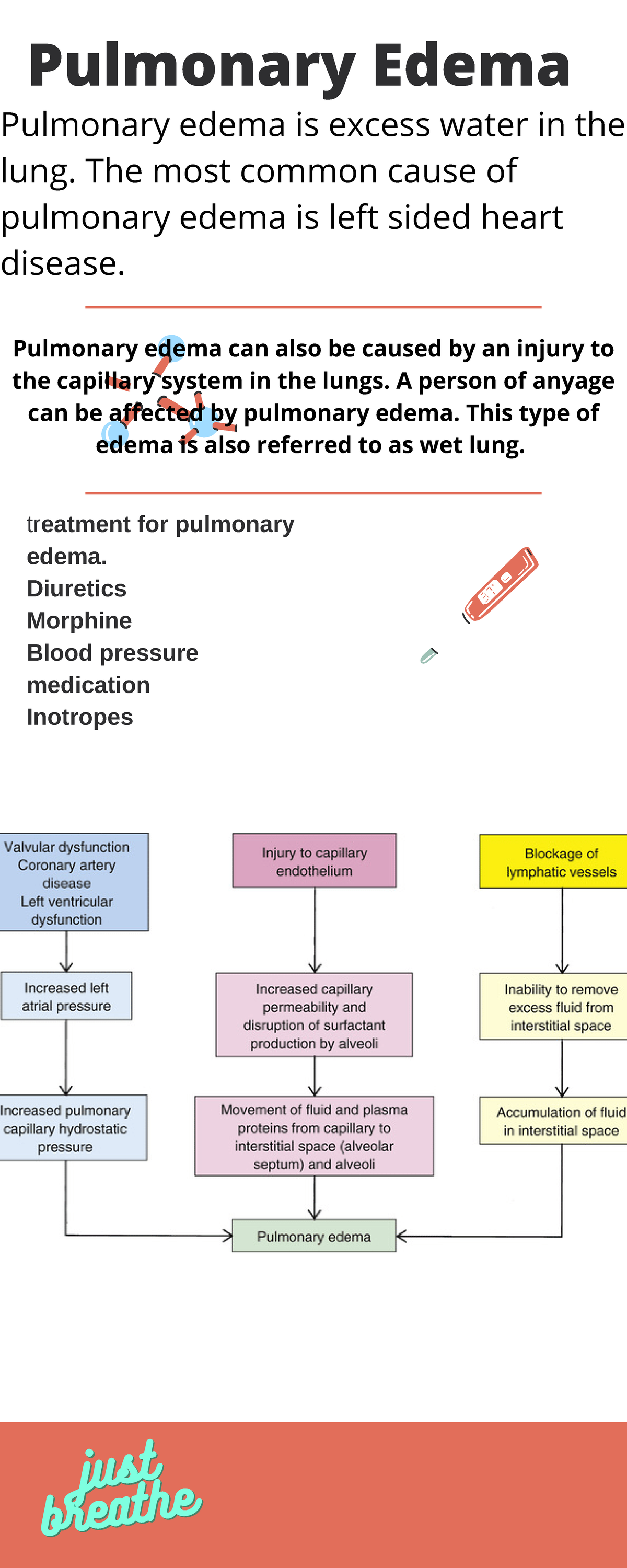 Pulmonary Edema infographic - treatment for pulmonary edema. Diuretics ...