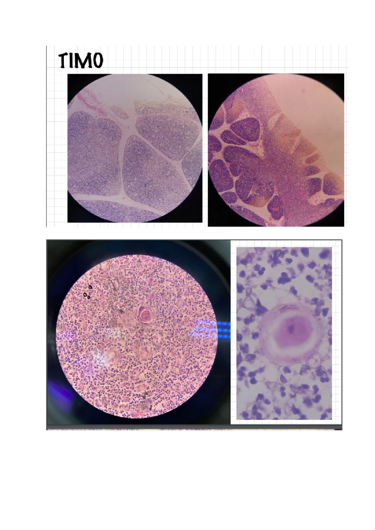 Micro 2-P placas Timo, Bazo, Ganglio linfático y amigdala - Cápsula ...