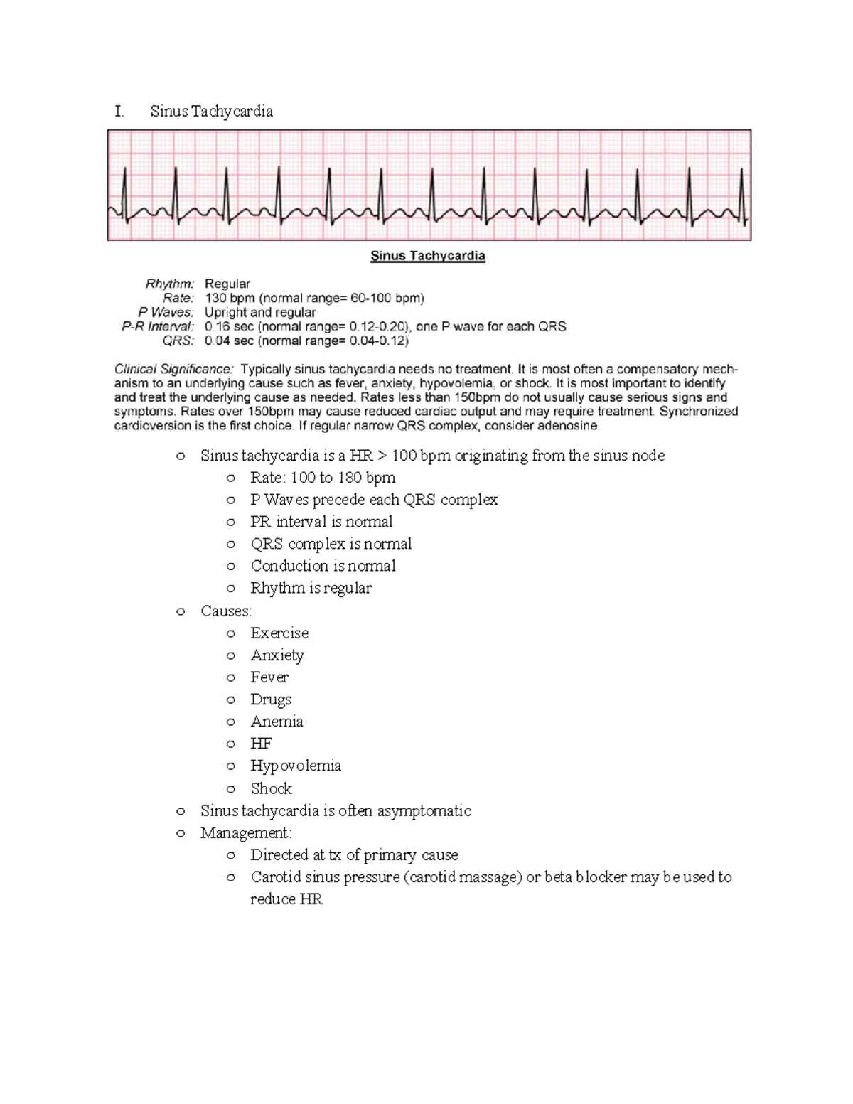 EKG Interpretation and Heart Arrhythmias - I. Sinus Tachycardia Sinus ...
