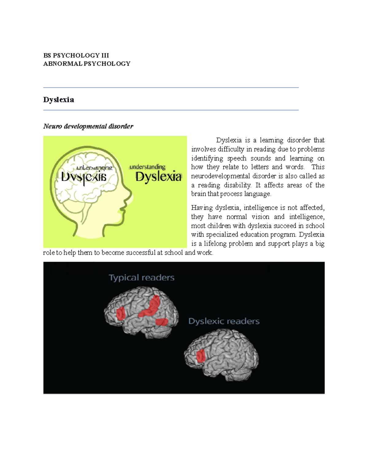 Dyslexia studoc - BS PSYCHOLOGY III ABNORMAL PSYCHOLOGY Dyslexia Neuro ...