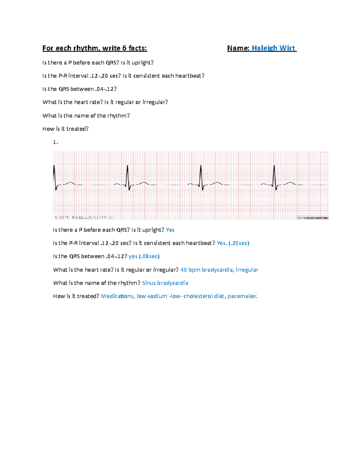 Aaa ECG Rhythm ID Assignment - For each rhythm, write 6 facts: Name ...