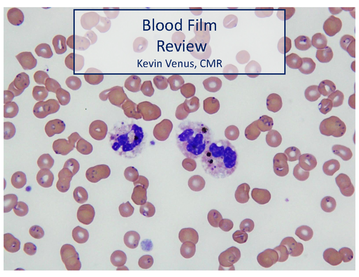 Blood film review for hematology and pathology - Blood Film Review ...