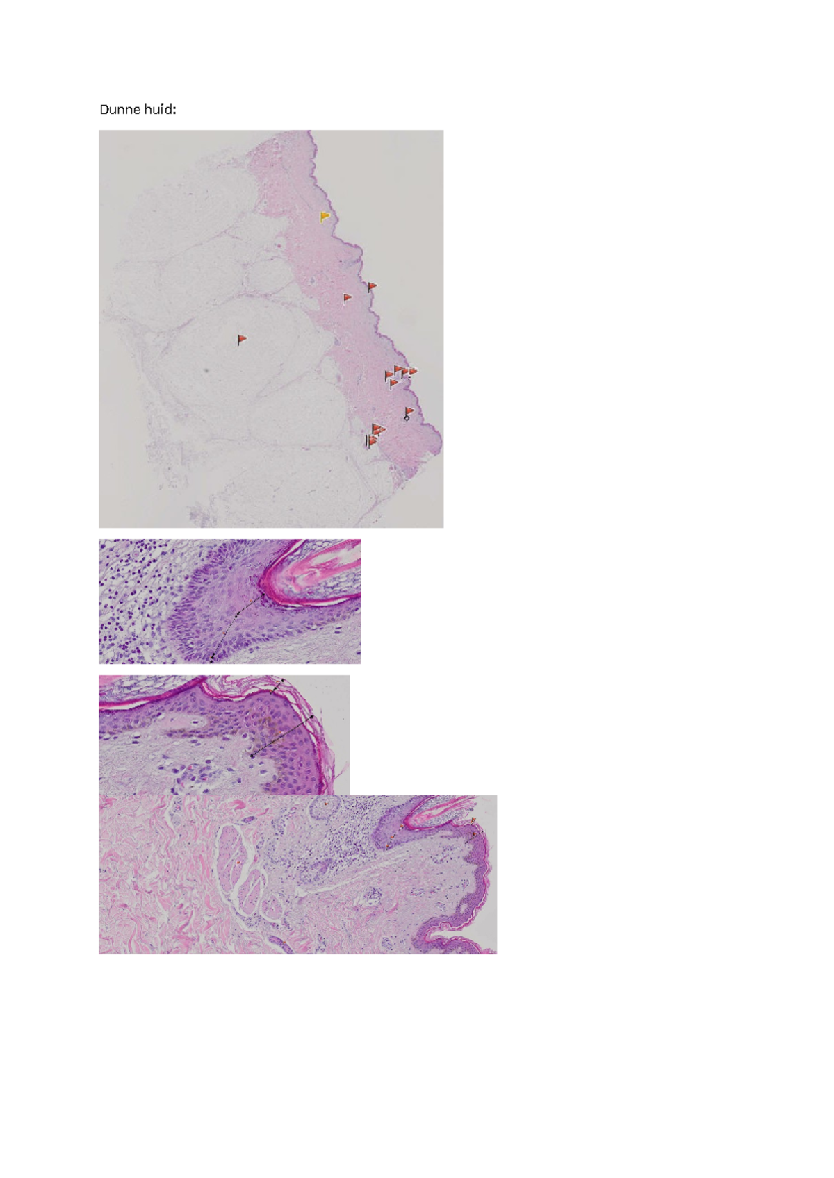 Practica weefsel - Dunne huid: Meerlagig verhoornd plaveiselepitheel ...