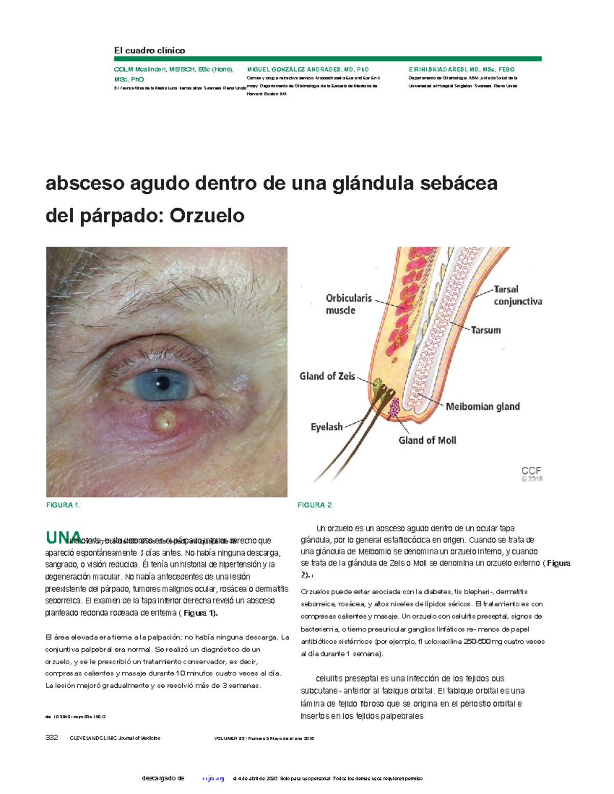 Artículo de oftalmologia - COLM Mcalinden, MB BCH, BSc (Hons), MSc, PhD ...