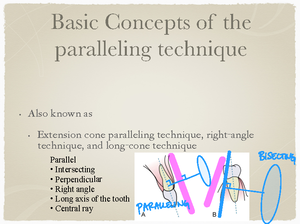 Lecture 10 - Mrs. Cherney. Fall 2022 - Maxillary Occlusal Projections ...