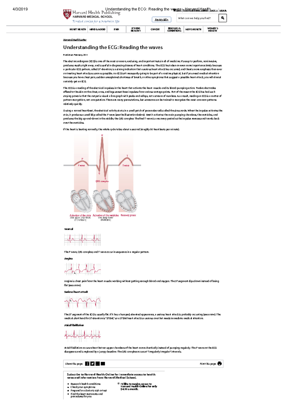 Understanding the ECG Reading the waves - Harvard Health ...