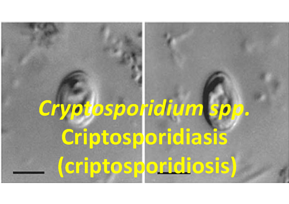 I.- Criptosporidiasis 2021 - Cryptosporidium spp. Criptosporidiasis ...