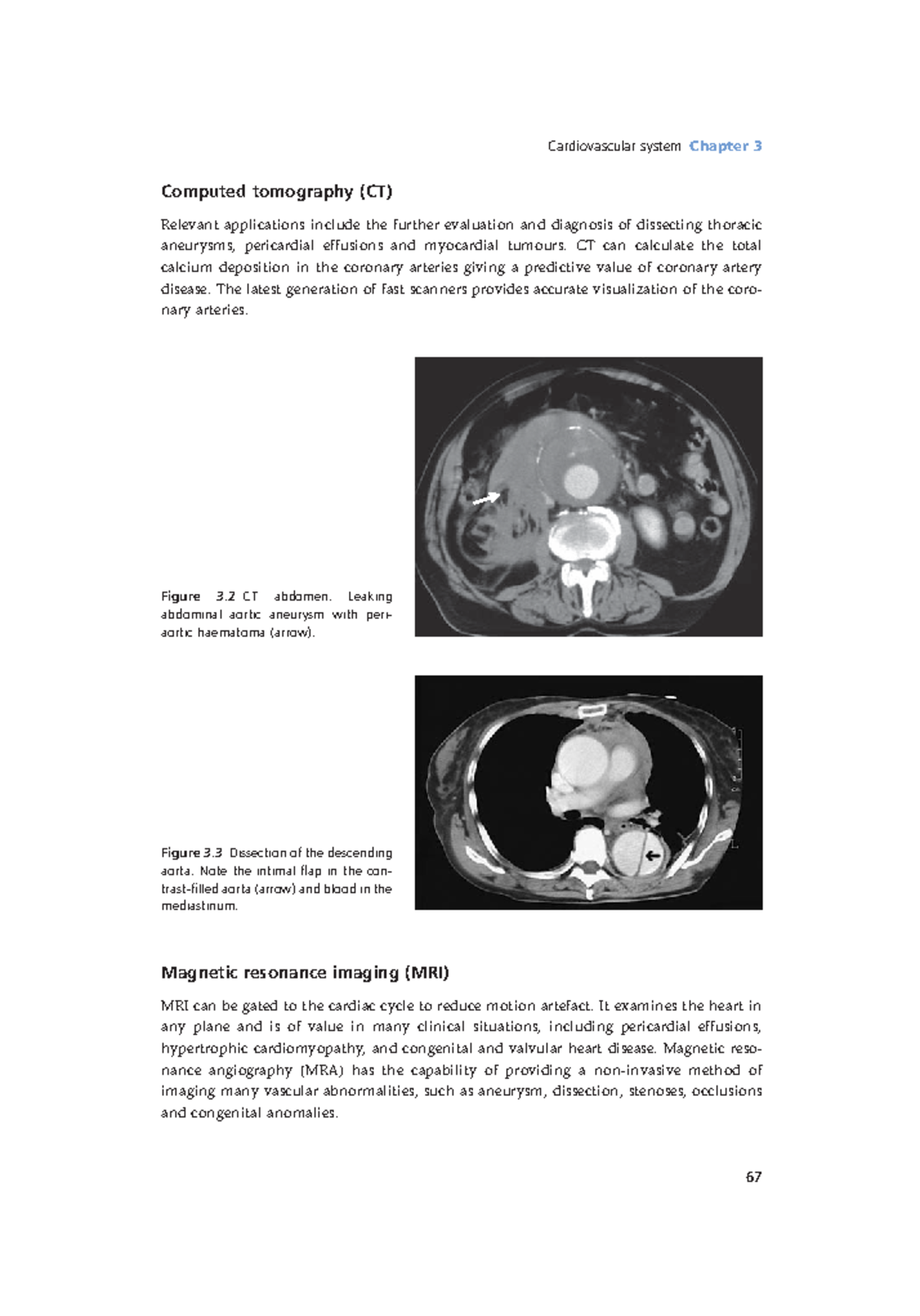 Radiology Lecture Notes Pdf 23 Cardiovascular System Chapter 3 67 Computed Tomography Ct