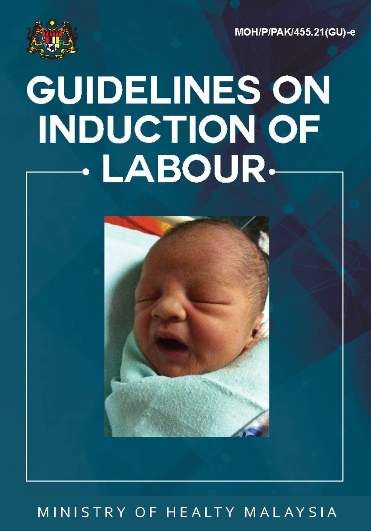 CPG Induction of Labour - MOH/P/PAK/455(GU)-e GUIDELINES ON INDUCTION ...