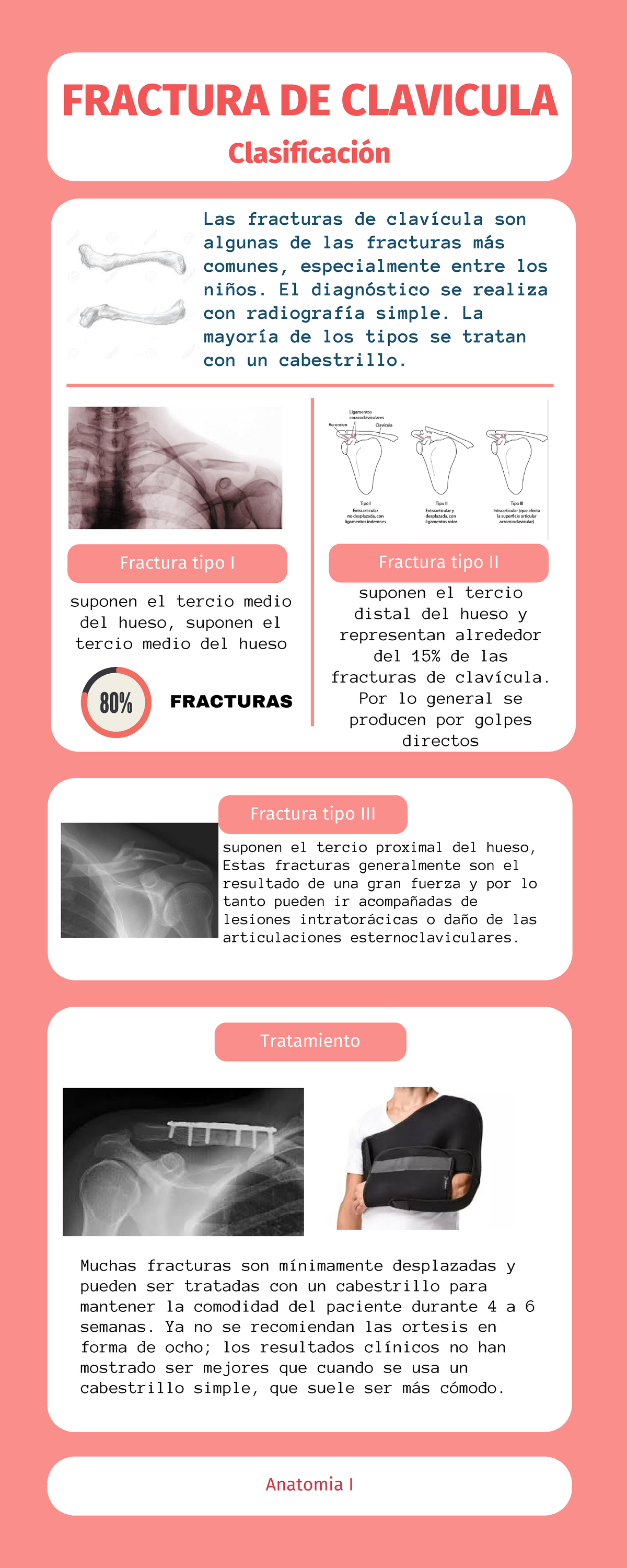 9 - Fractura de clavicula - Fractura tipo I Fractura tipo II Anatomia I ...