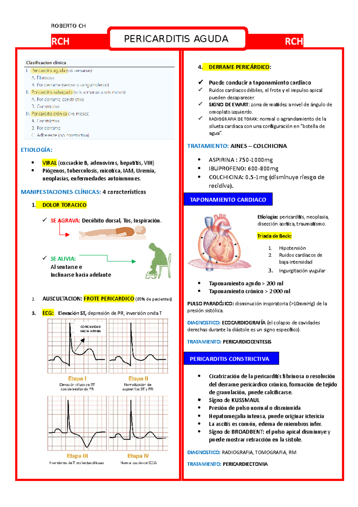 Pericarditis Aguda - ROBERTO CH RCH NEMAT ODOS RCH 4. DERRAME ...