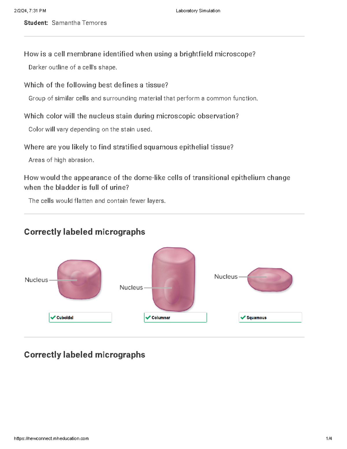 Virtual lab Epithelial Tissue histology - Student: Samantha Temores How ...
