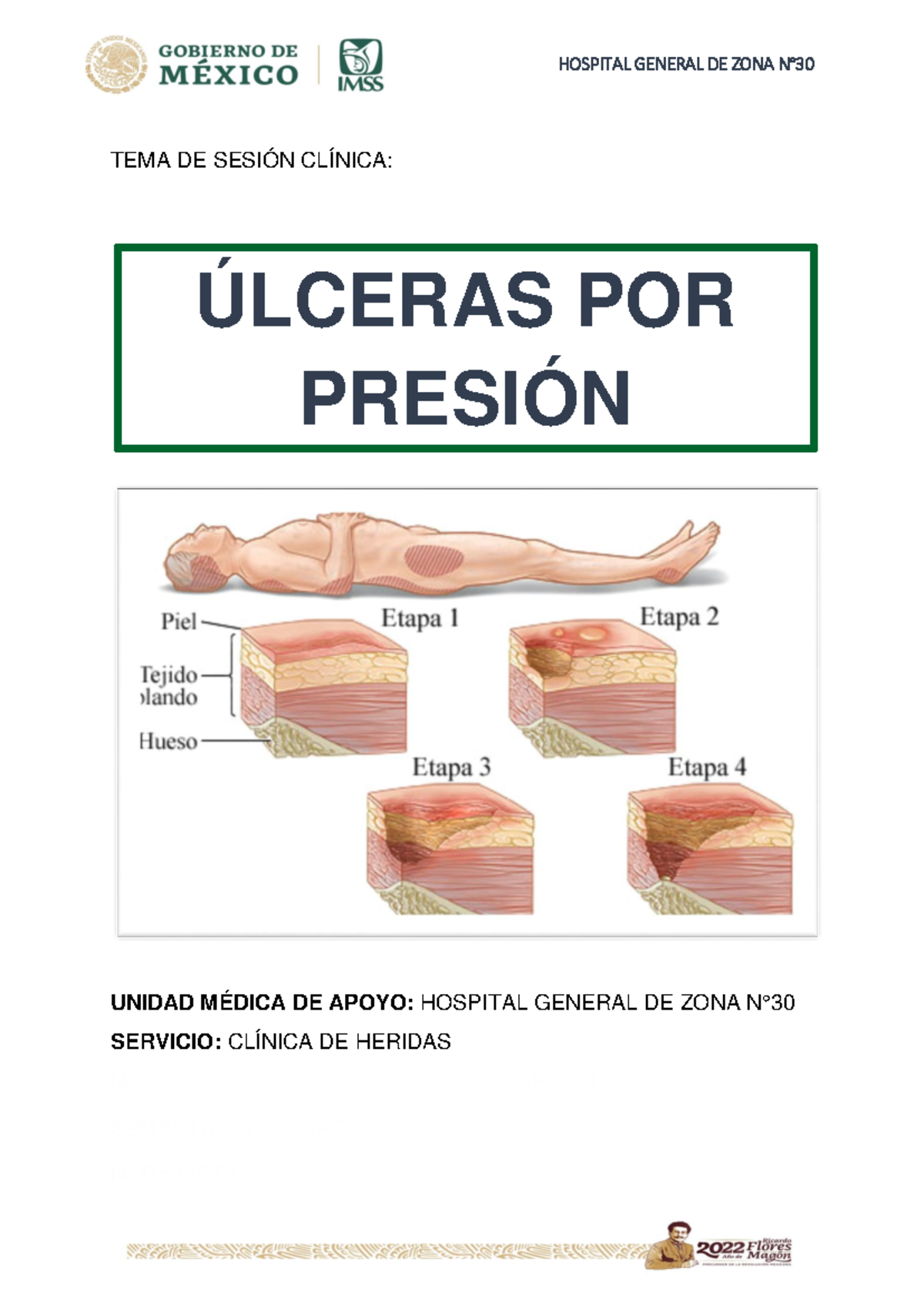 Sesión Clínica: Úlceras por Presión - TEMA DE SESIÓN CLÍNICA: UNIDAD ...