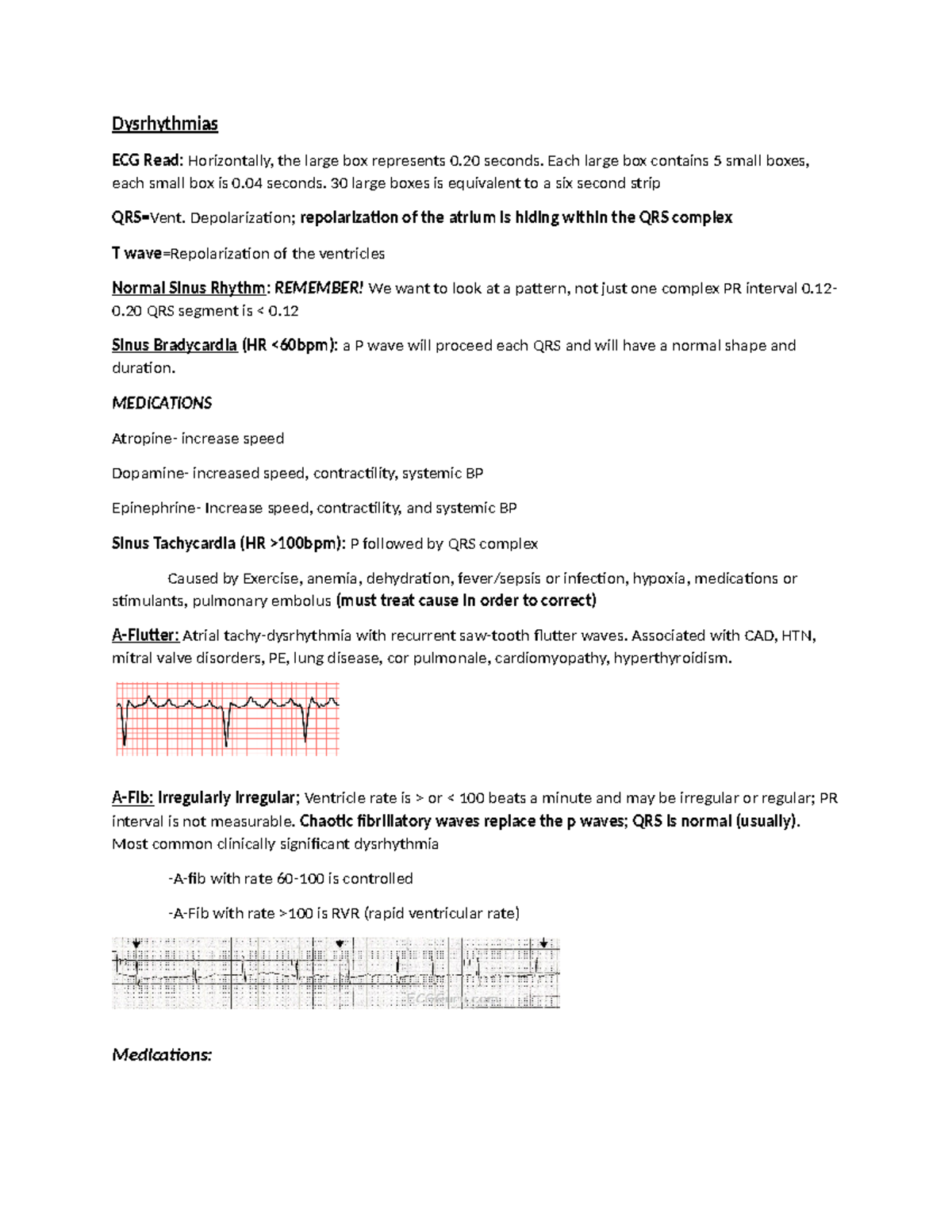 Cardiac Study info - Dysrhythmias ECG Read: Horizontally, the large box ...