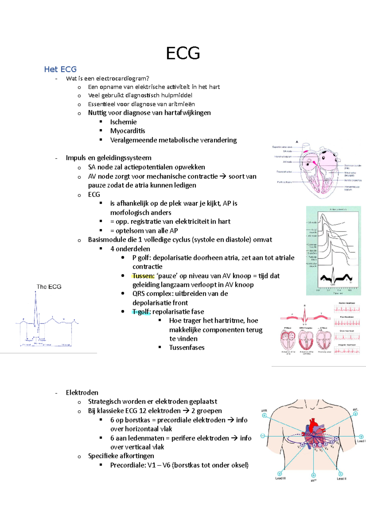 ECG - samenvatting aantekeningen ECG - ECG Het ECG Wat is een ...