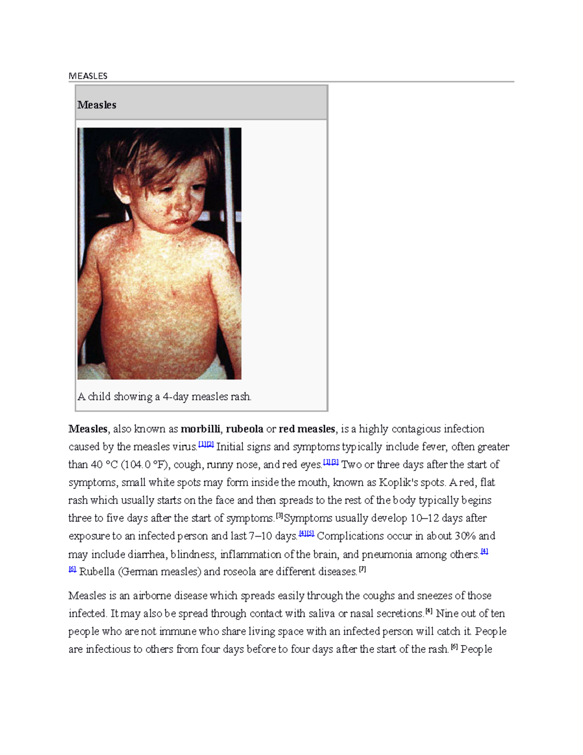 Measles - MEASLES Measles A child showing a 4-day measles rash. Measles ...