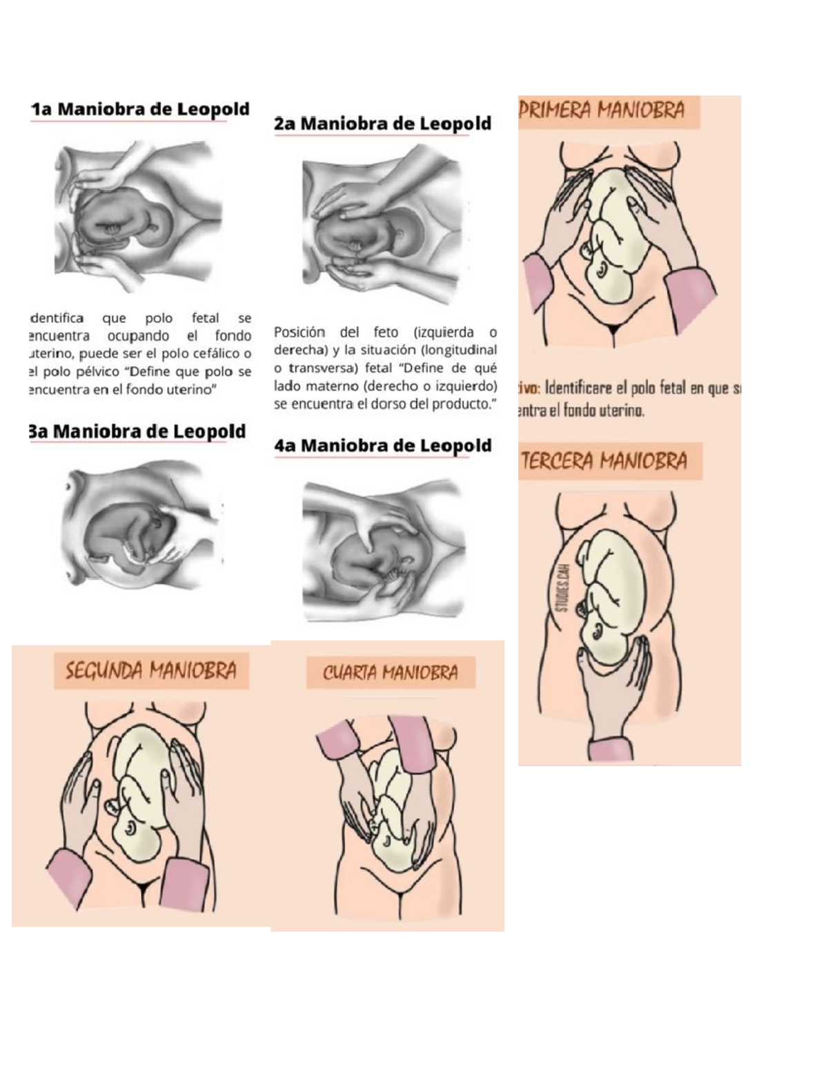 Maneobras de leopold - SABER COMO REALIZAR PROCEDIMIENTOS - 1a Maniobra ...