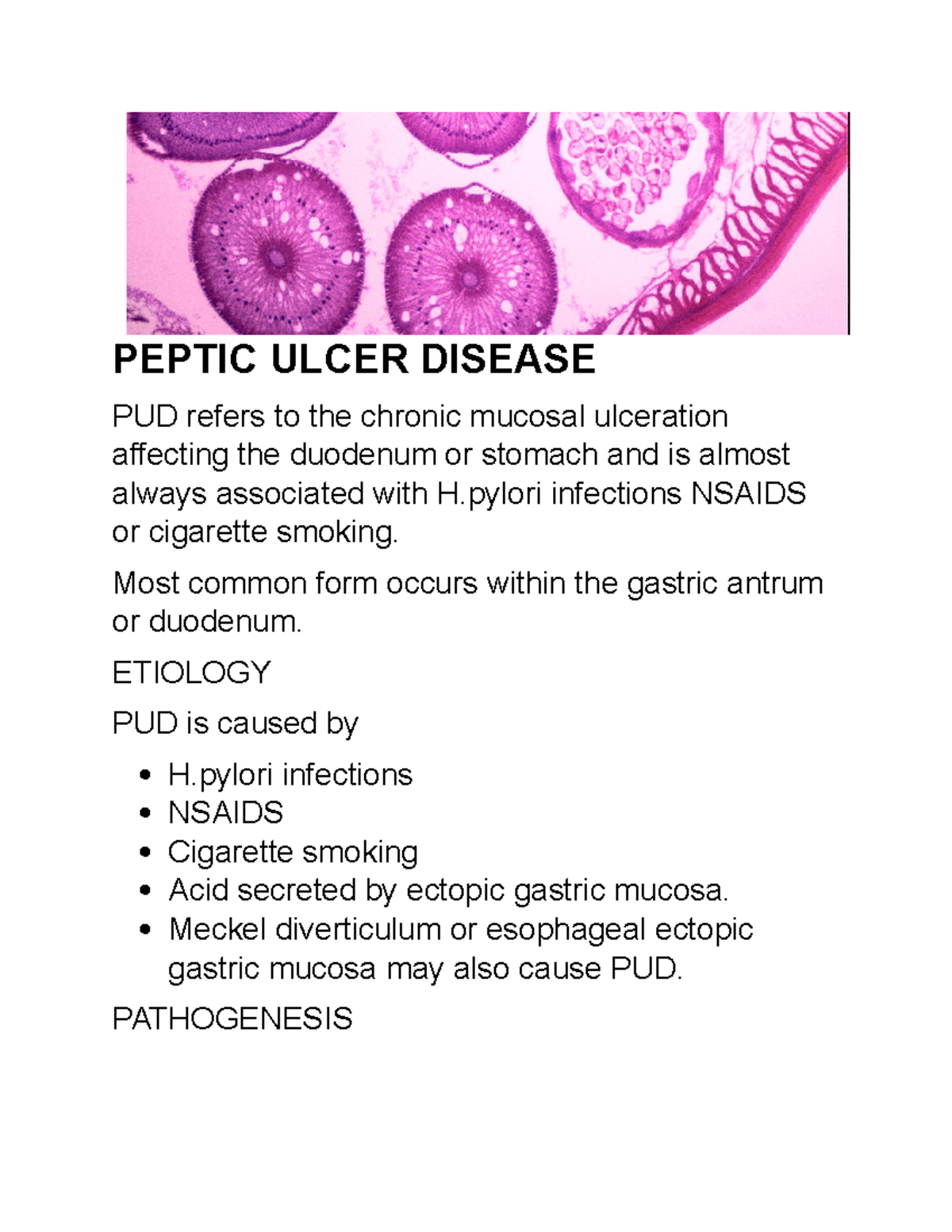 Pathology notes - PEPTIC ULCER DISEASE PUD refers to the chronic ...