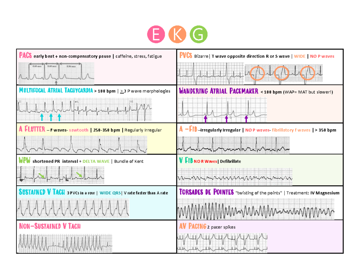 EKGand Acid Baseand Electrolytes - 🅔🅚🅖 PACs early beat + non ...