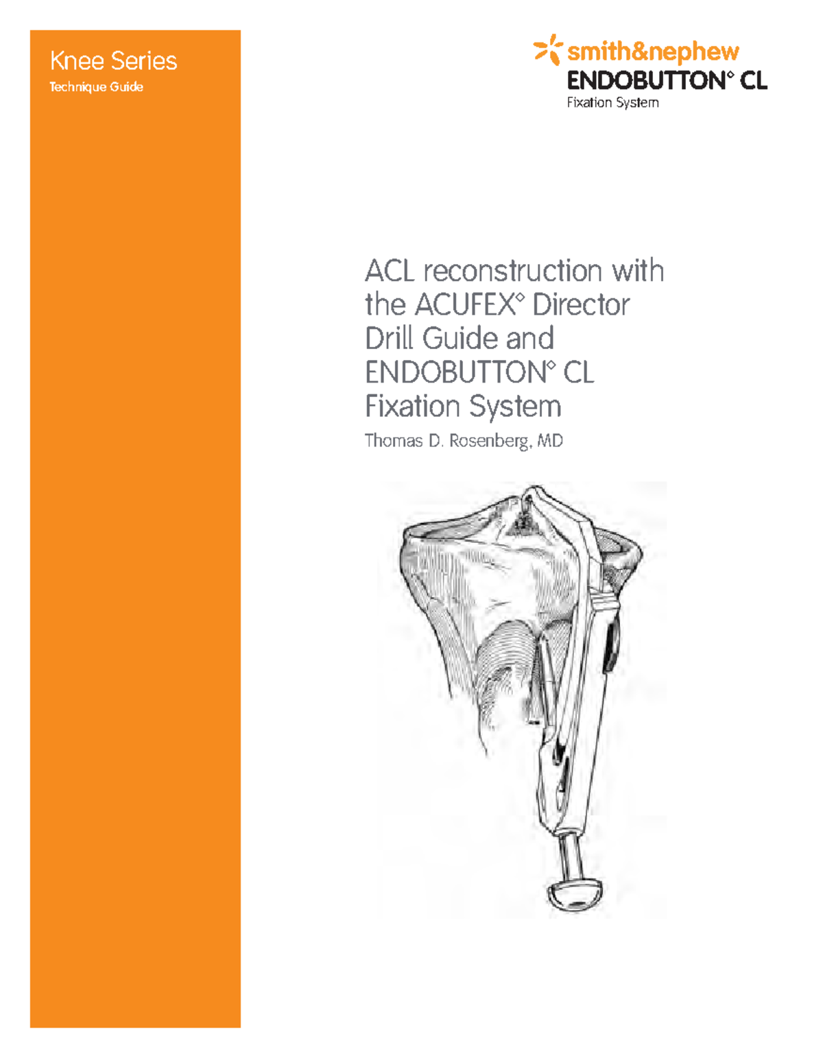 10600026 reva acl endobutton cl st 05 2005 - ACL reconstruction with ...