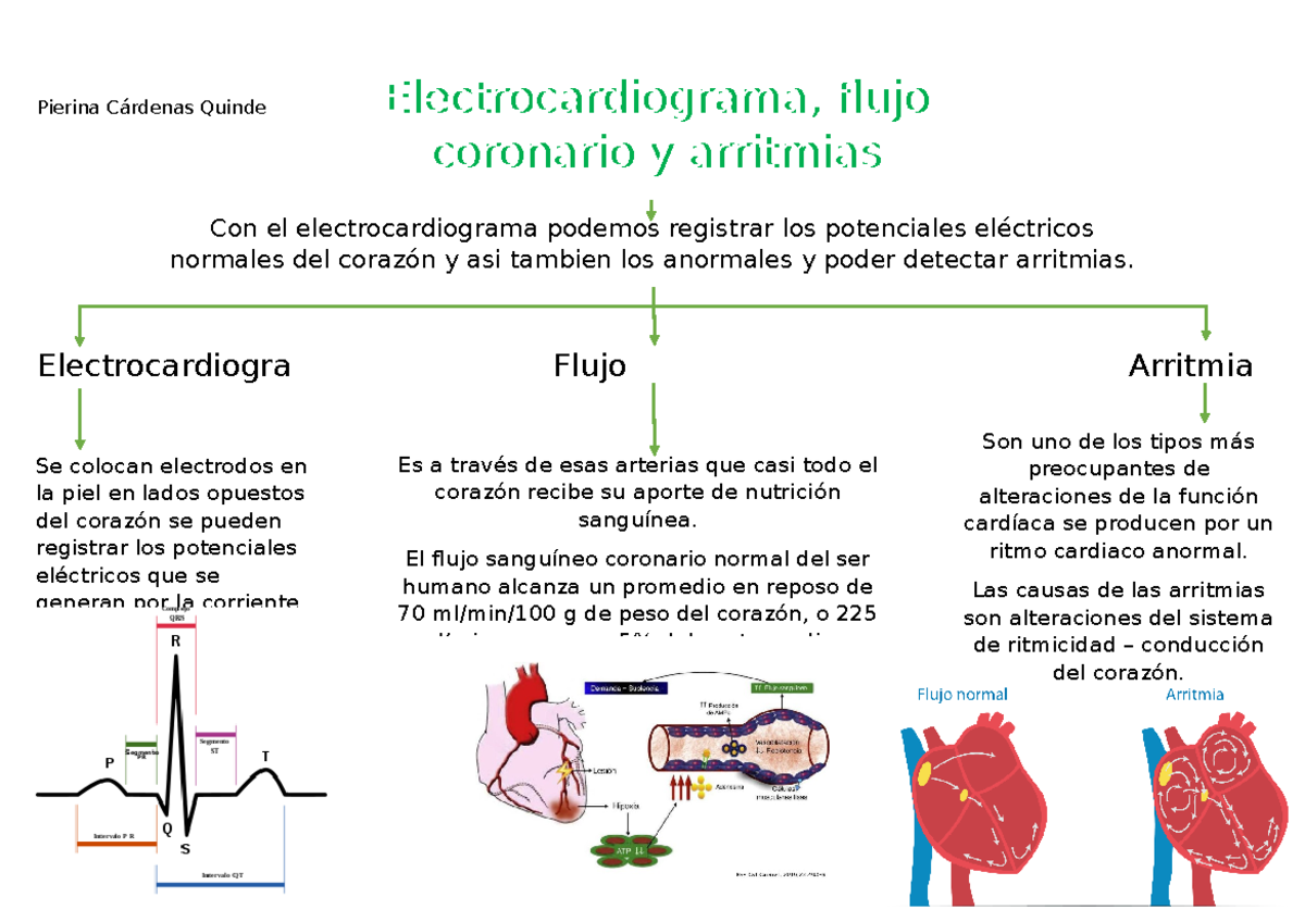 Esquema Electrocardiograma - Pierina Cárdenas Quinde Electrocardiograma ...