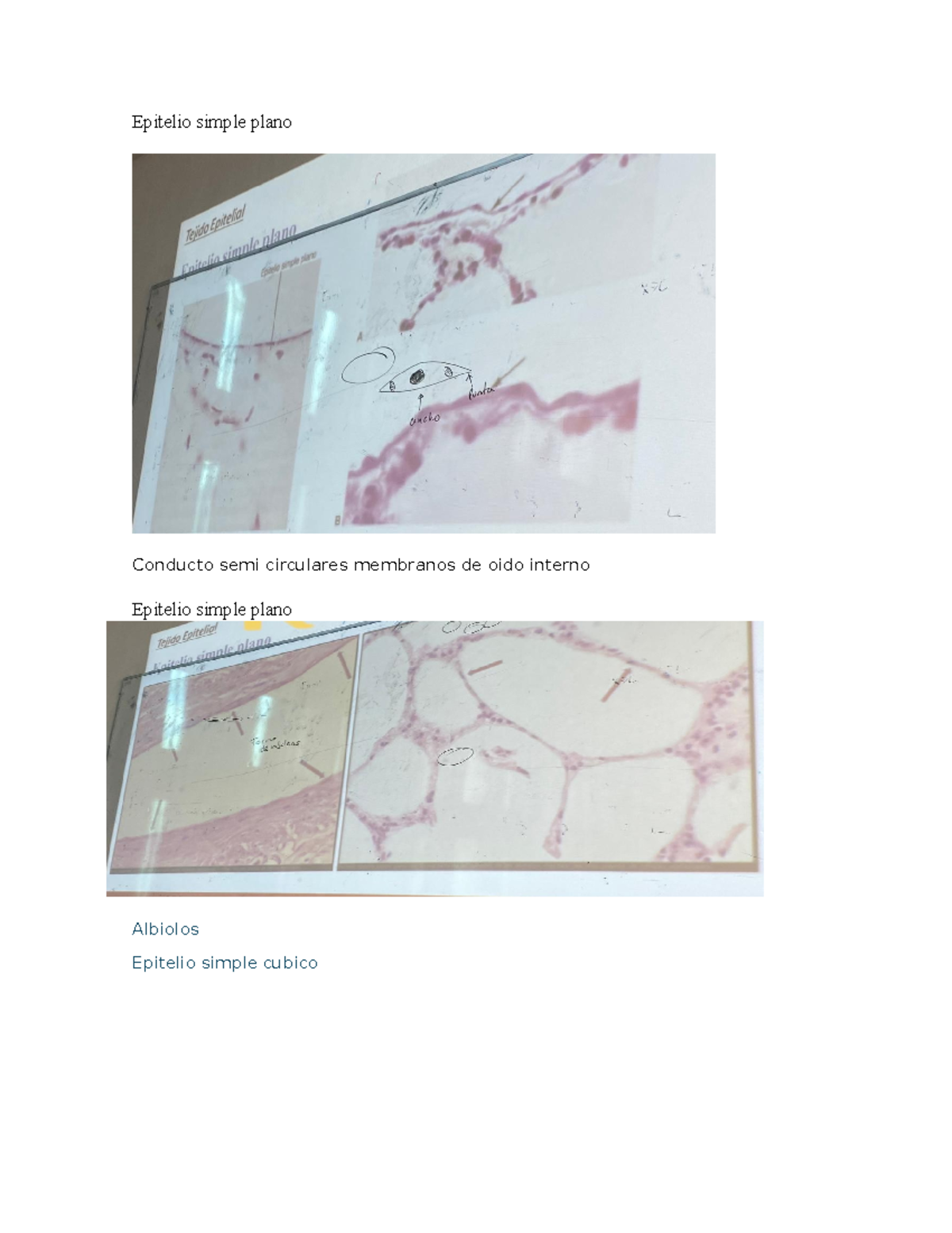 Epitelio simple plano - Epitelio simple plano Conducto semi circulares ...