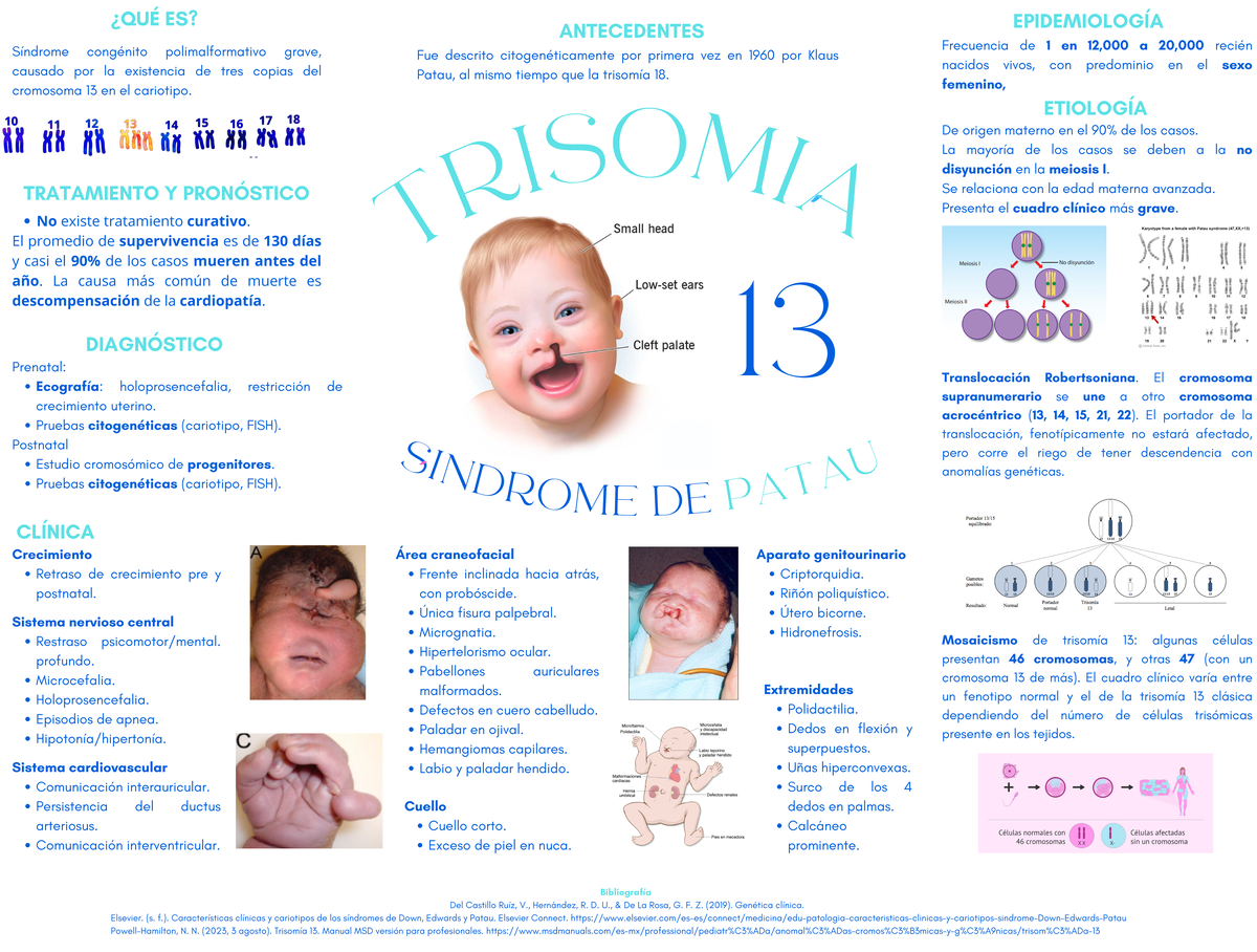 Trisomía 18 - De origen materno en el 90% de los casos. La mayoría de ...