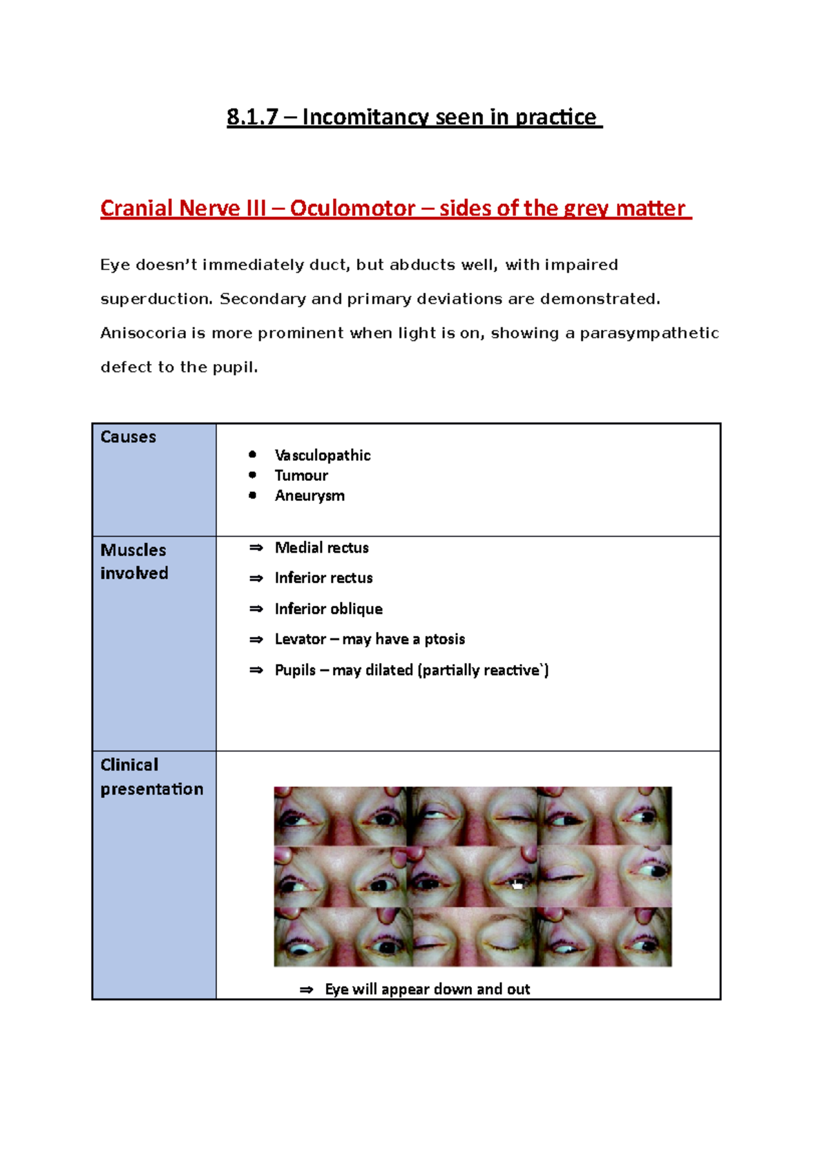 Binocular vision and paeds - 8.1 – Incomitancy seen in practice Cranial ...