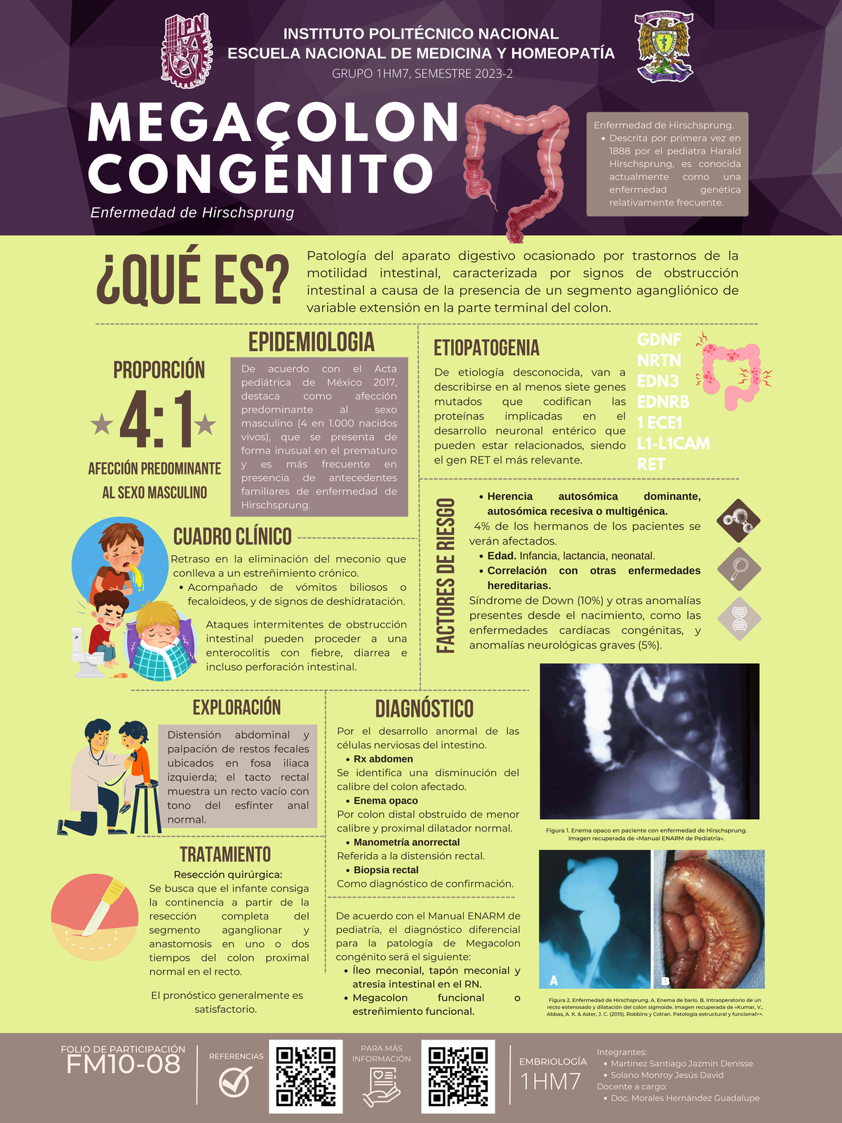 Megacolon congénito (90 × 120 cm) - Descrita por primera vez en 1888 ...