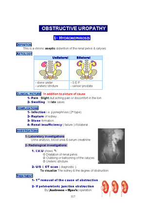 Calcular anuria - uro-surgery course - Malignancy (renal pelvis ...