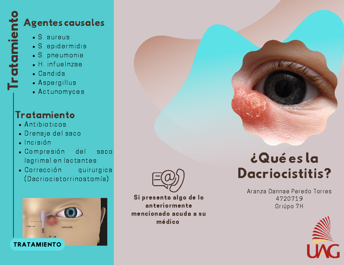 Triptico Dacriocistitis - Tratamiento Si presenta algo de lo ...