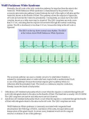ECG reading materials with direct example for practice - ACLS EKG STUDY ...