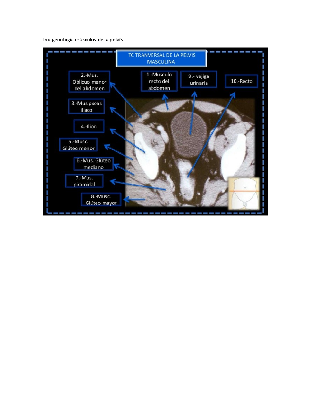 Musculos de la pelvis - Resumen Netter Atlas De Anatomia Humana ...