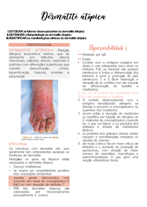 O HPV - Condilomatose e Vacina HPV Yasmin Ferreira HPV Papiloma v írus ...