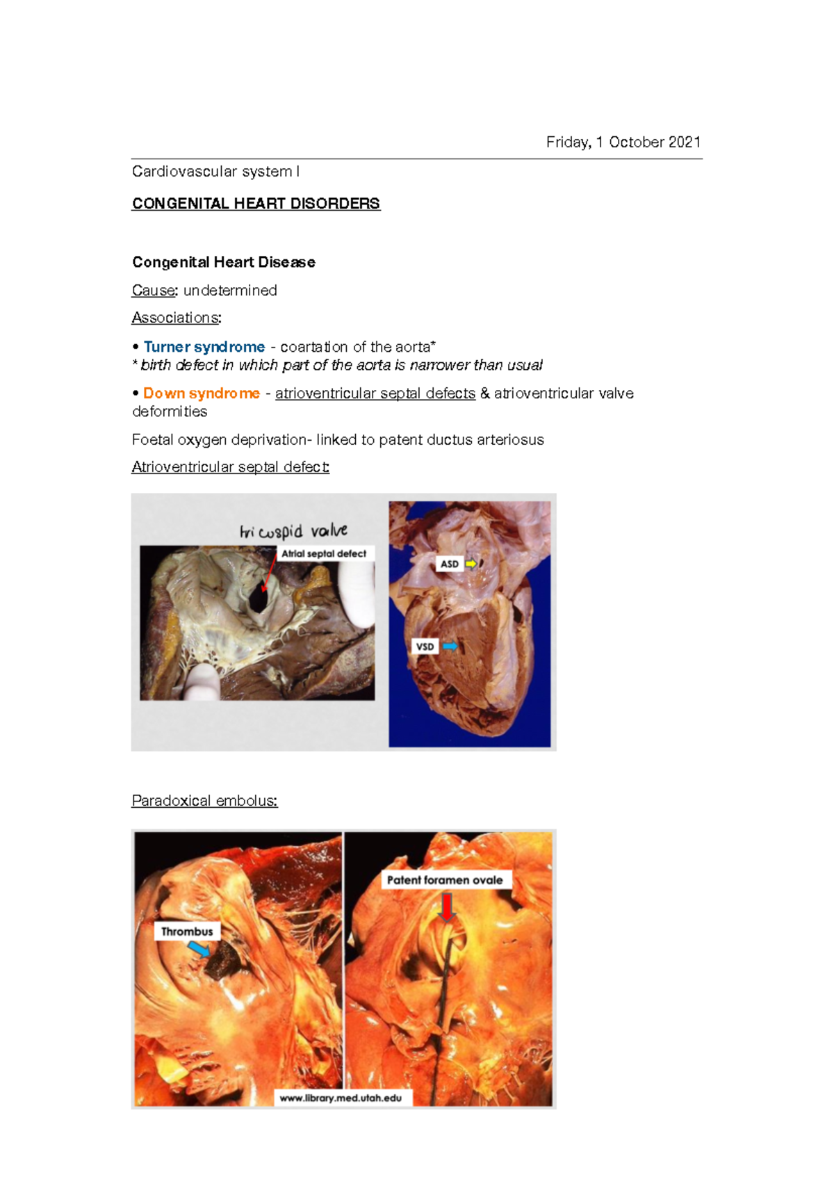 Cardiovarscular pathology - Cardiovascular system I CONGENITAL HEART ...