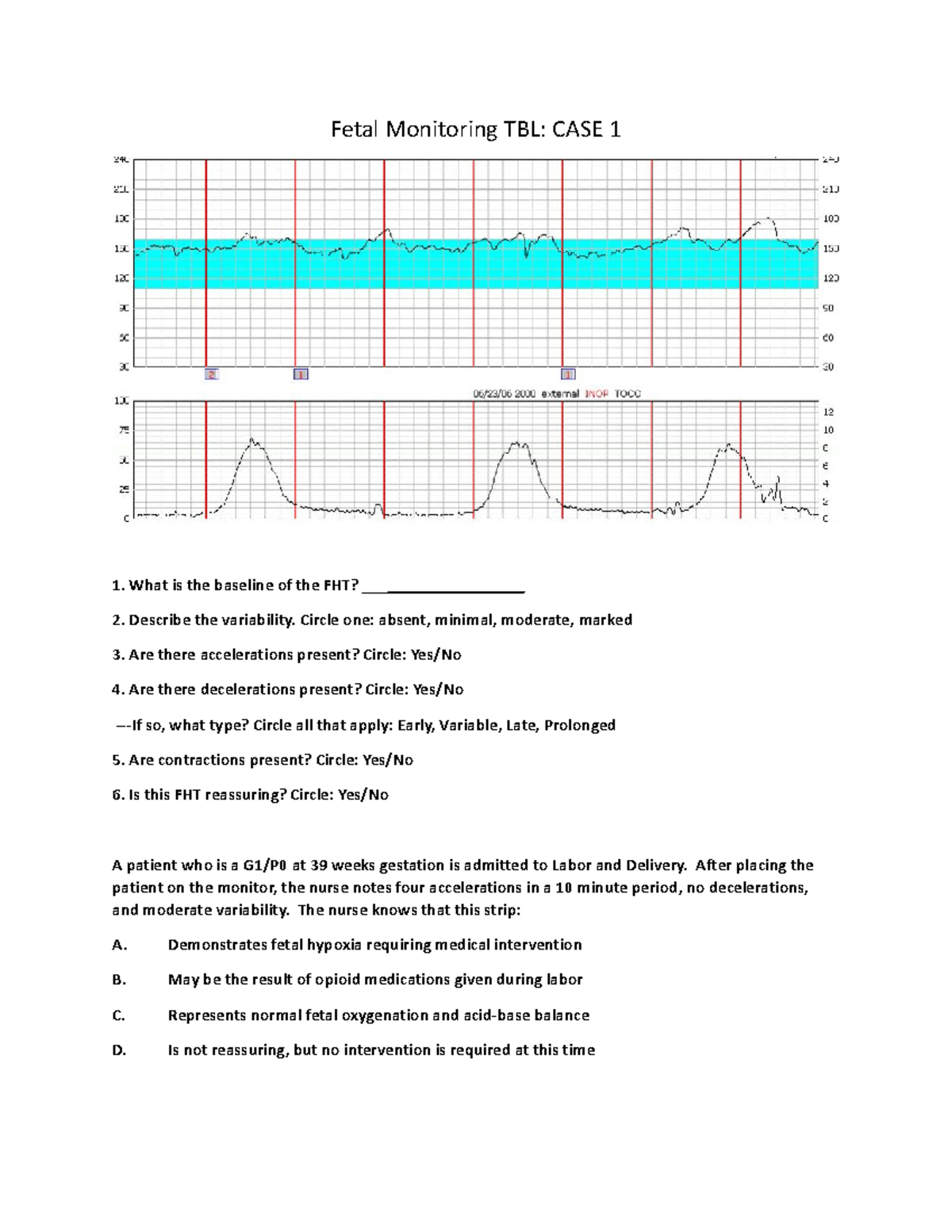Fetal Monitoring Practice Case Studies-1 - What is the baseline of the ...