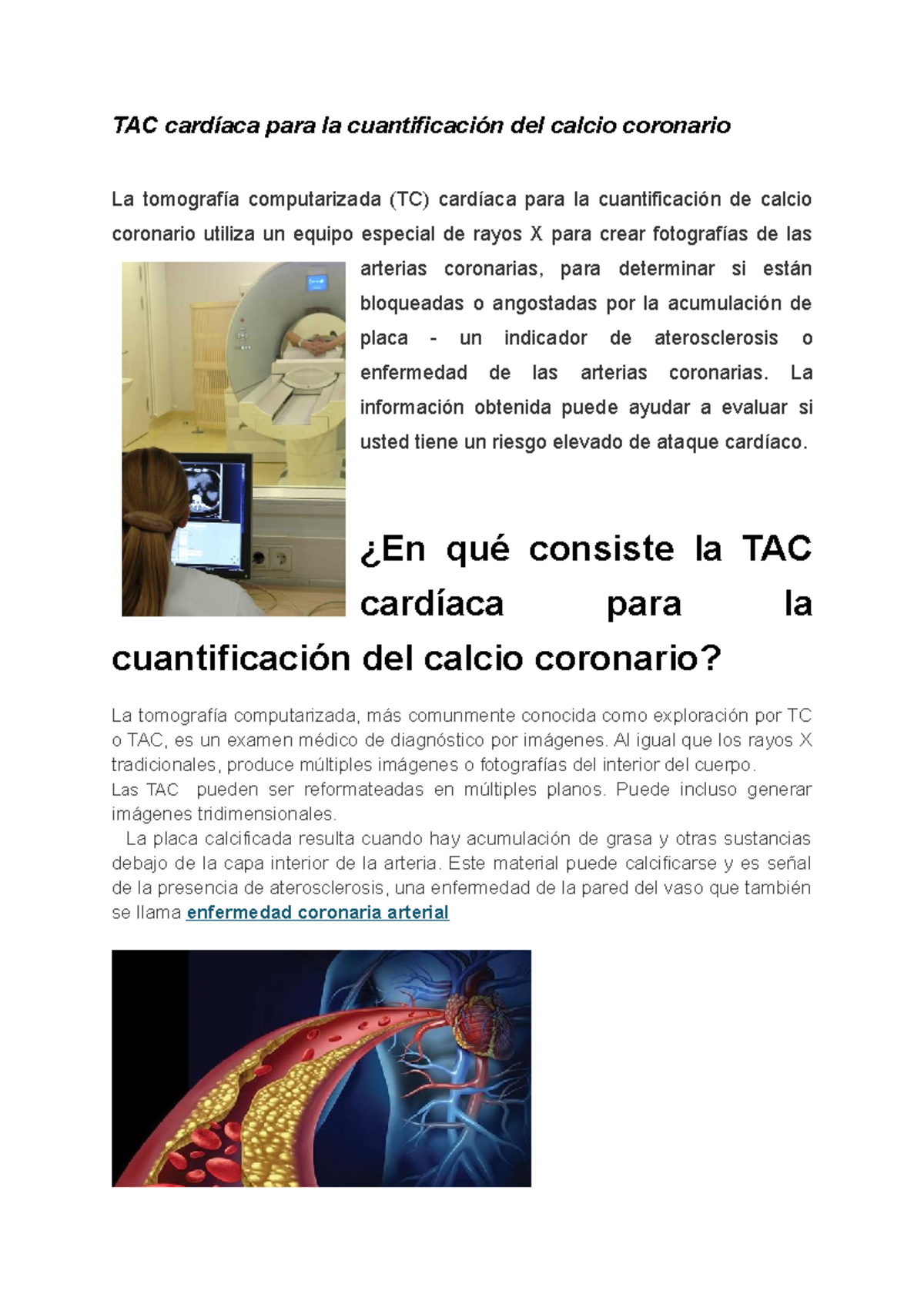 Imagenologia - DOCUMENTOS DE IMAGINOLOGIA - TAC cardíaca para la ...