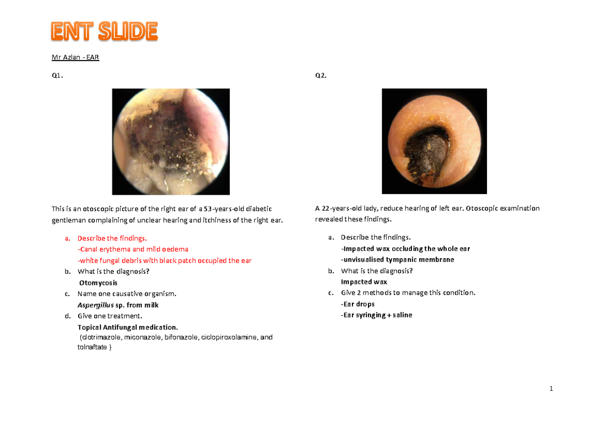 O7 ENT-OSCE-Mr-Azlan - ENT OSCE - Mr Azlan - EAR Q1. This is an ...