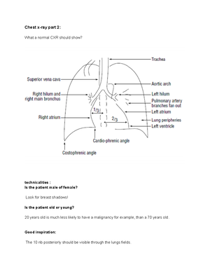 Normal Chest Anatomy - Radiographic Anatomy of the Adult Chest Plain PA ...