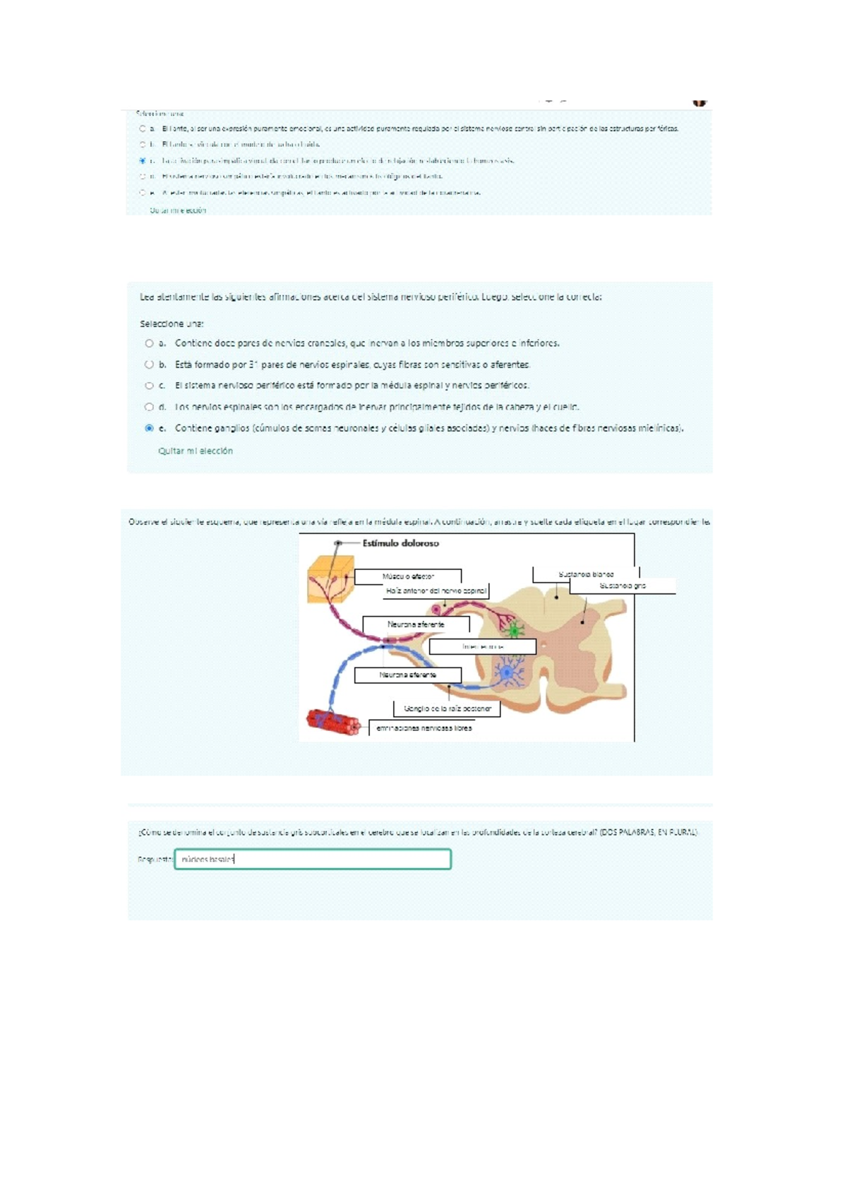 TP Neuro Snerv - Seleccione una: El llanto, al ser una expresión puramente emocional, es una ...