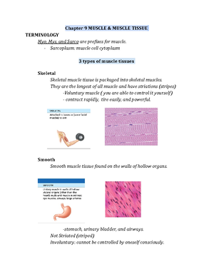 [Solved] Motor neuron disease MND is a set of neurodegenerative ...